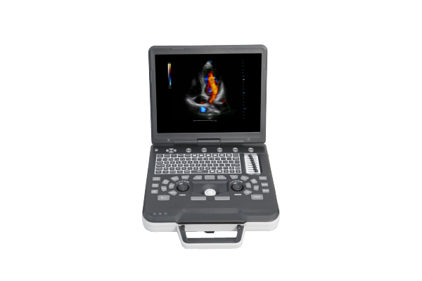 Color Doppler